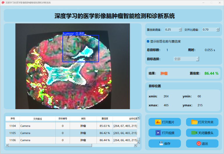 基于yolov8深度学习的脑肿瘤智能检测系统设计与实现pyqt5界面数据集训练代码 中猿创新 7zcode